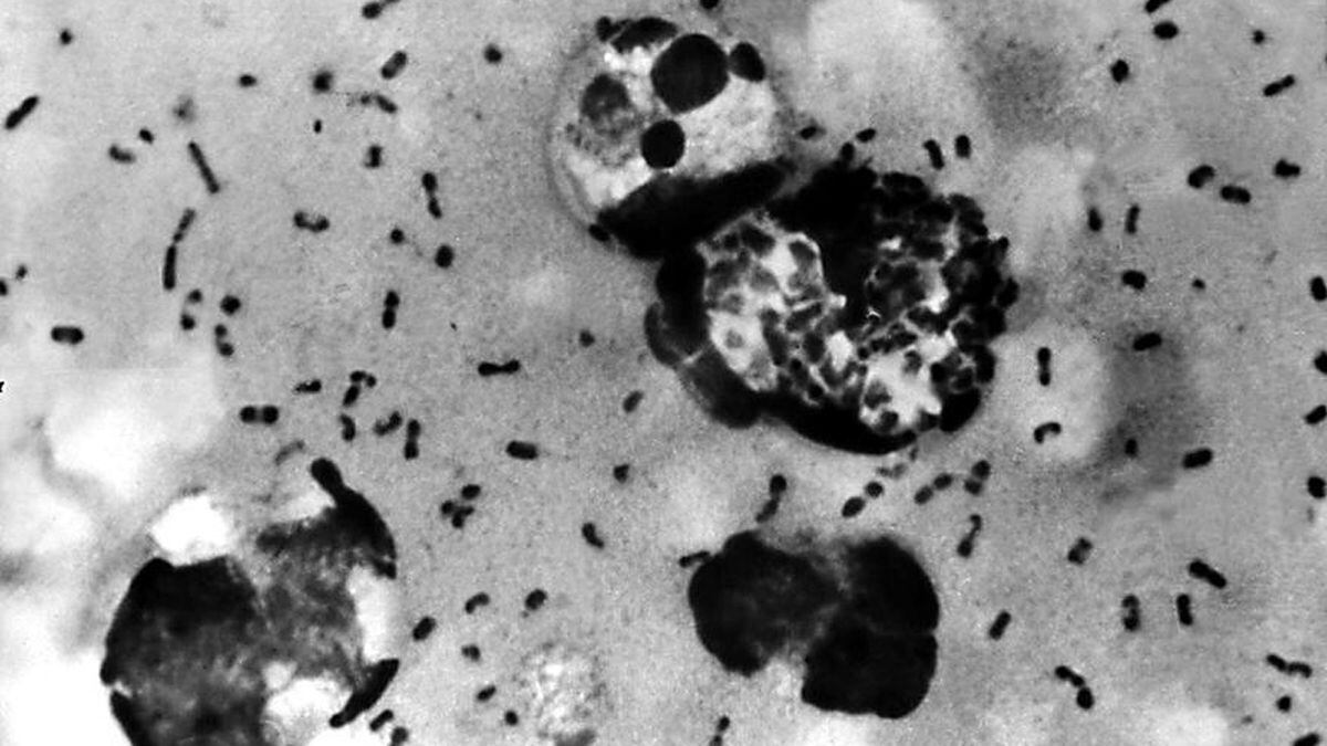 First human case of plague in state since 1992 hits Idaho, child recovering